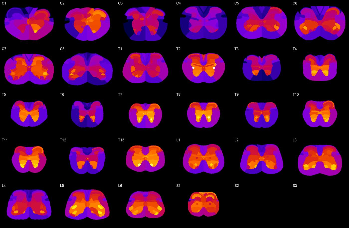 New Map of Mouse Spinal Cord Provides a Reference for Science and ... New Map of Mouse Spinal Cord Provides a Reference for Science and ...